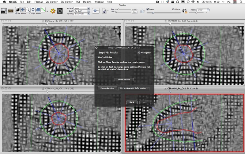 inTag : Cardiac MRI tagging analysis toolbox - Introduction