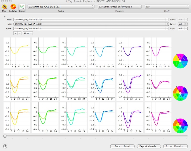 inTag : Cardiac MRI tagging analysis toolbox - Introduction