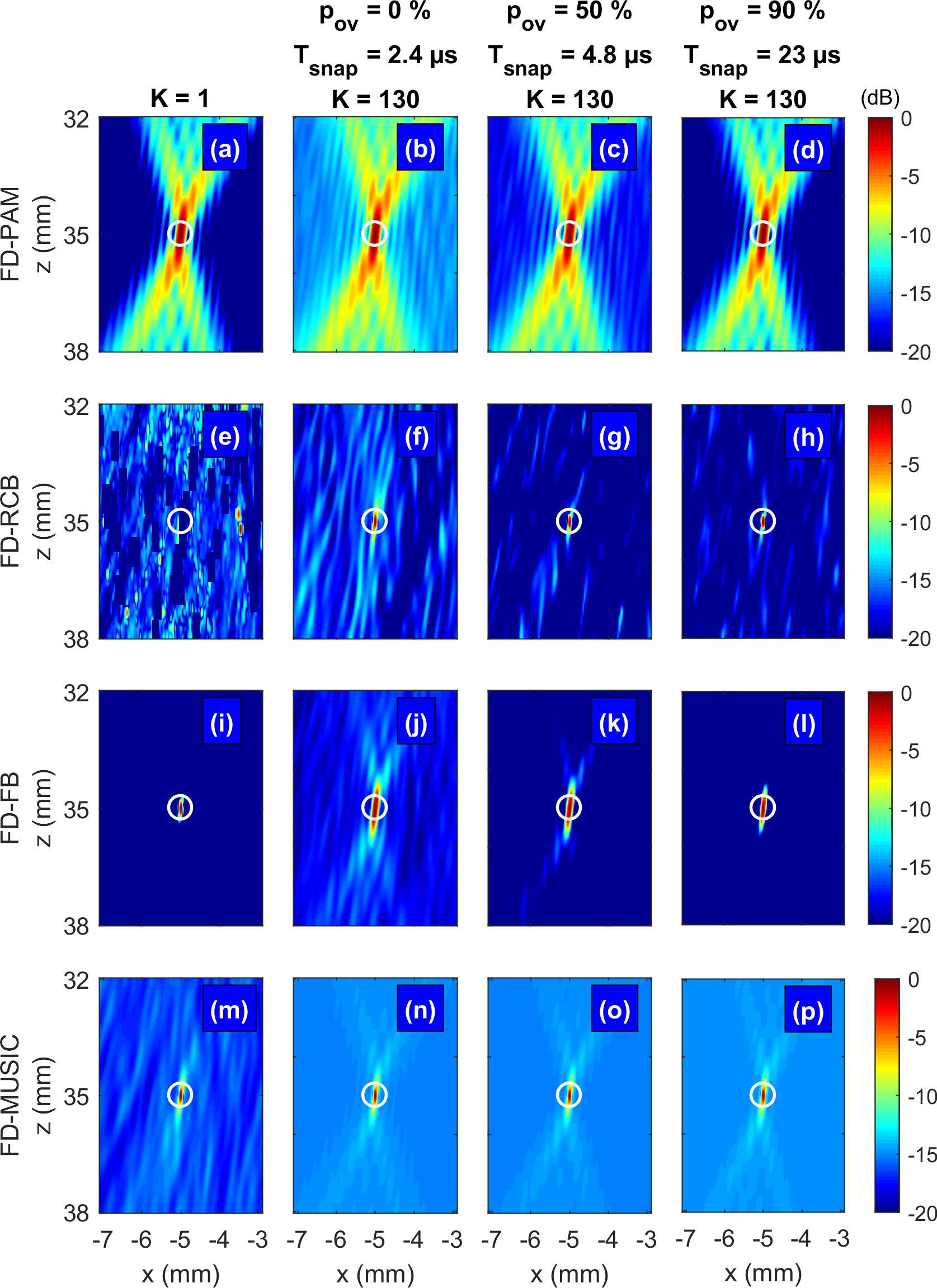 Receive Beamforming | CREATIS