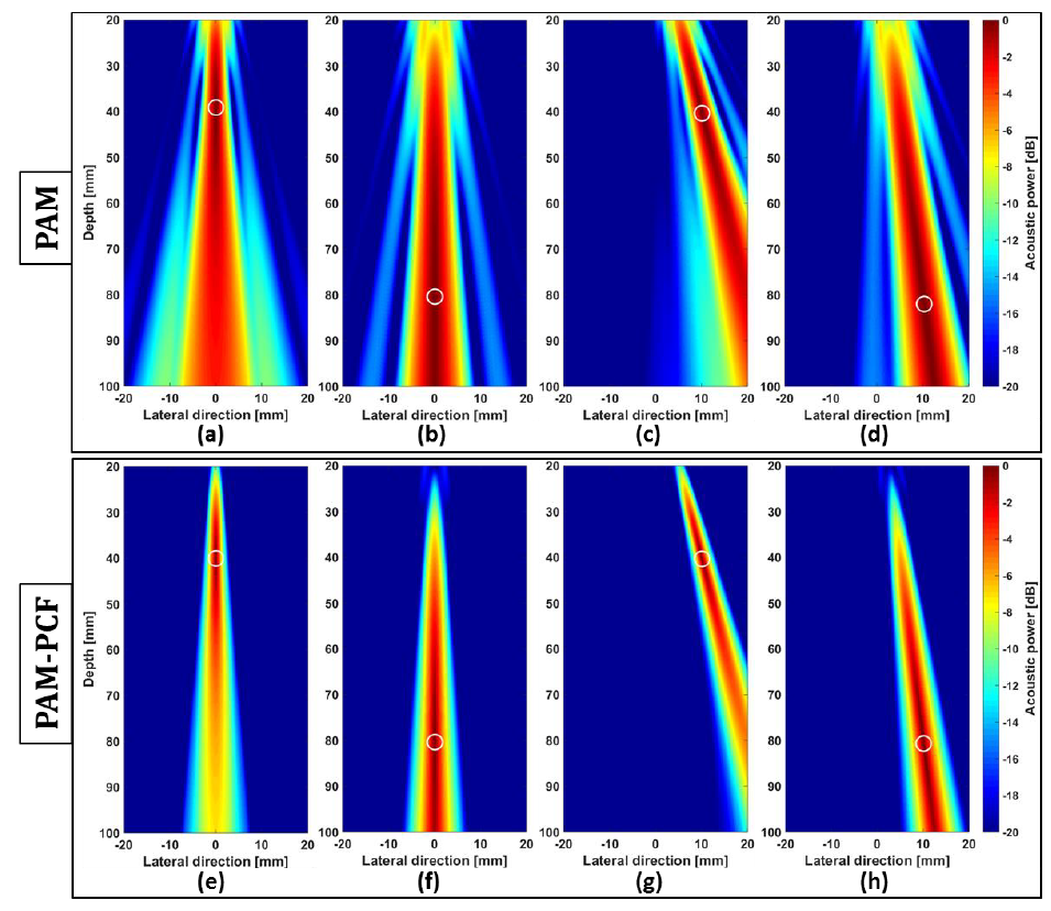 Receive Beamforming | CREATIS