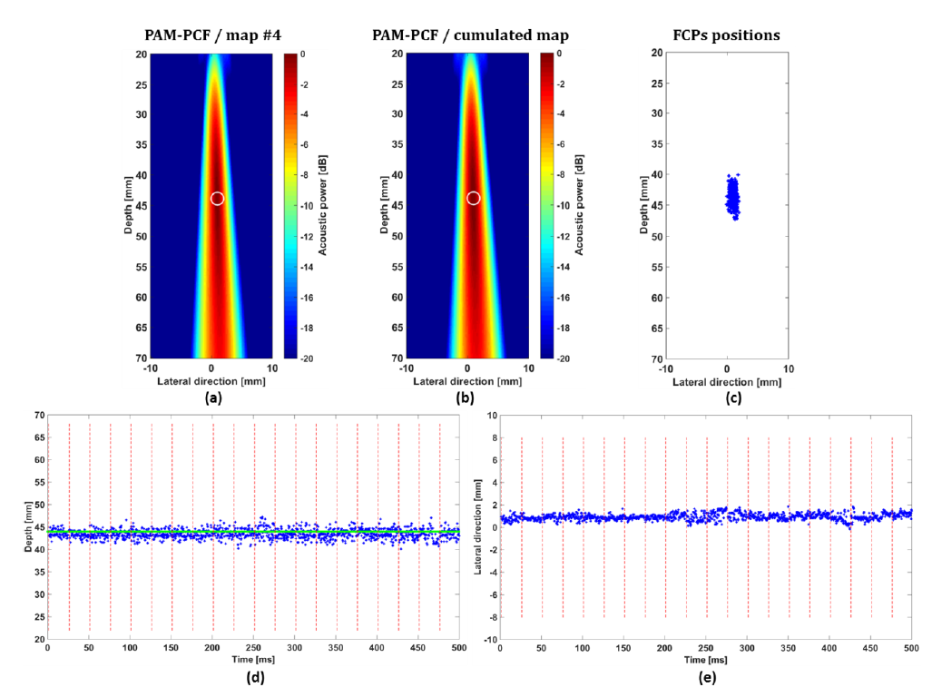 Receive Beamforming | CREATIS