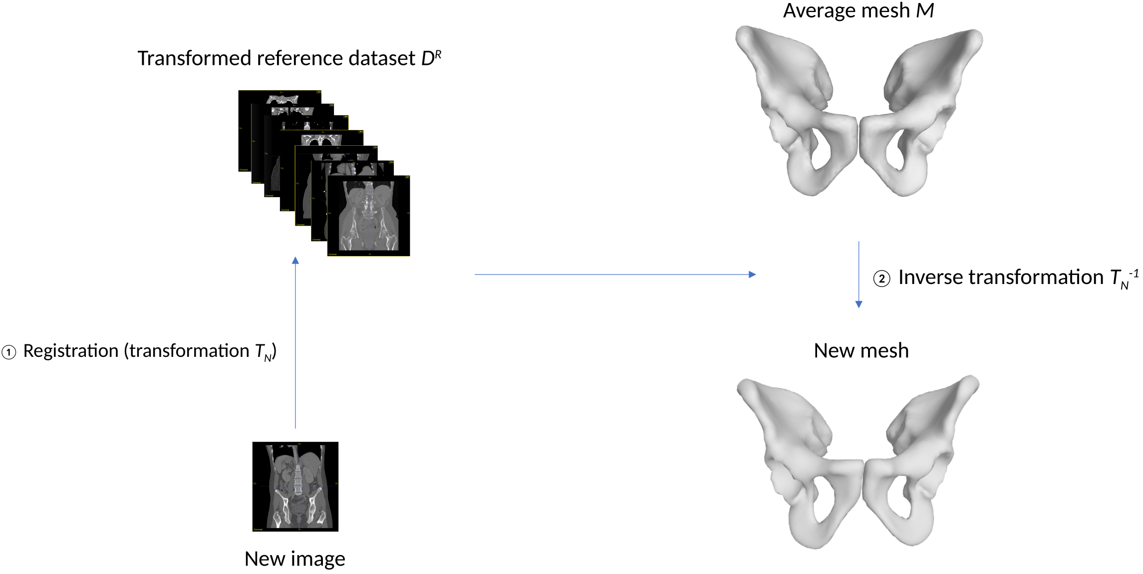Sex Estimation From Coxal Bones Using Deep Learning In A Population