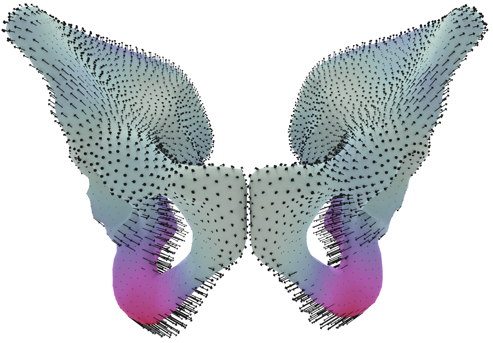 Disentangled Representations Towards Interpretation Of Sex Determination From Hip Bone 